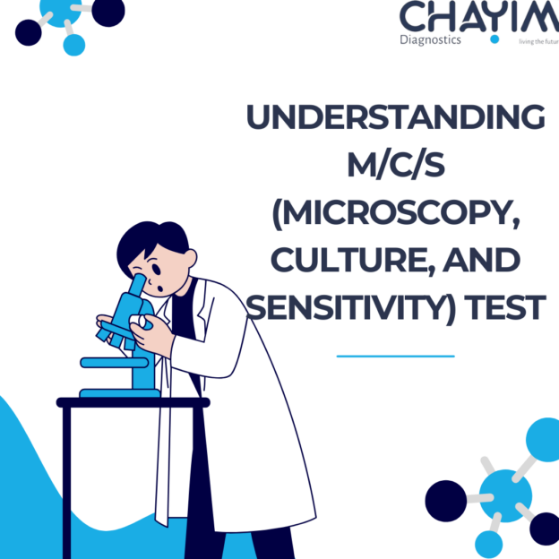 Understanding M/C/S Test